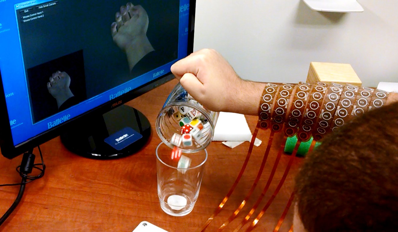 NeuroLife, the brain implant that can ‘cure’ paralysis | South China ...