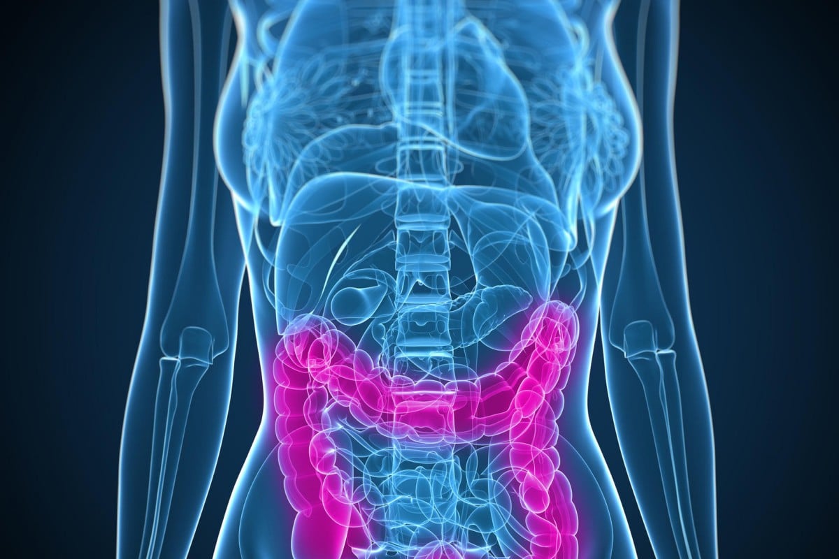 Colonic hydrotherapy has no proven benefits and carries risks | South ...