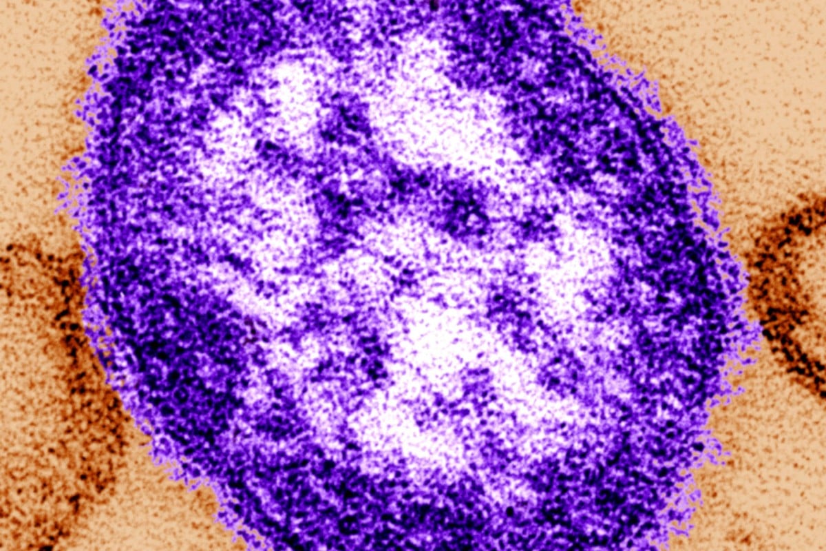 Measles: make sure you are immunised before travelling overseas | South ...