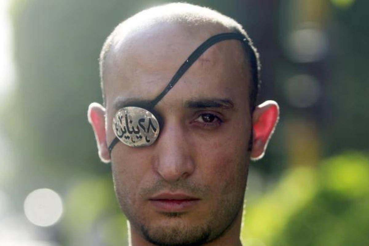 'Eye Sniper' jailed for three years, but police culture remains brutal ...