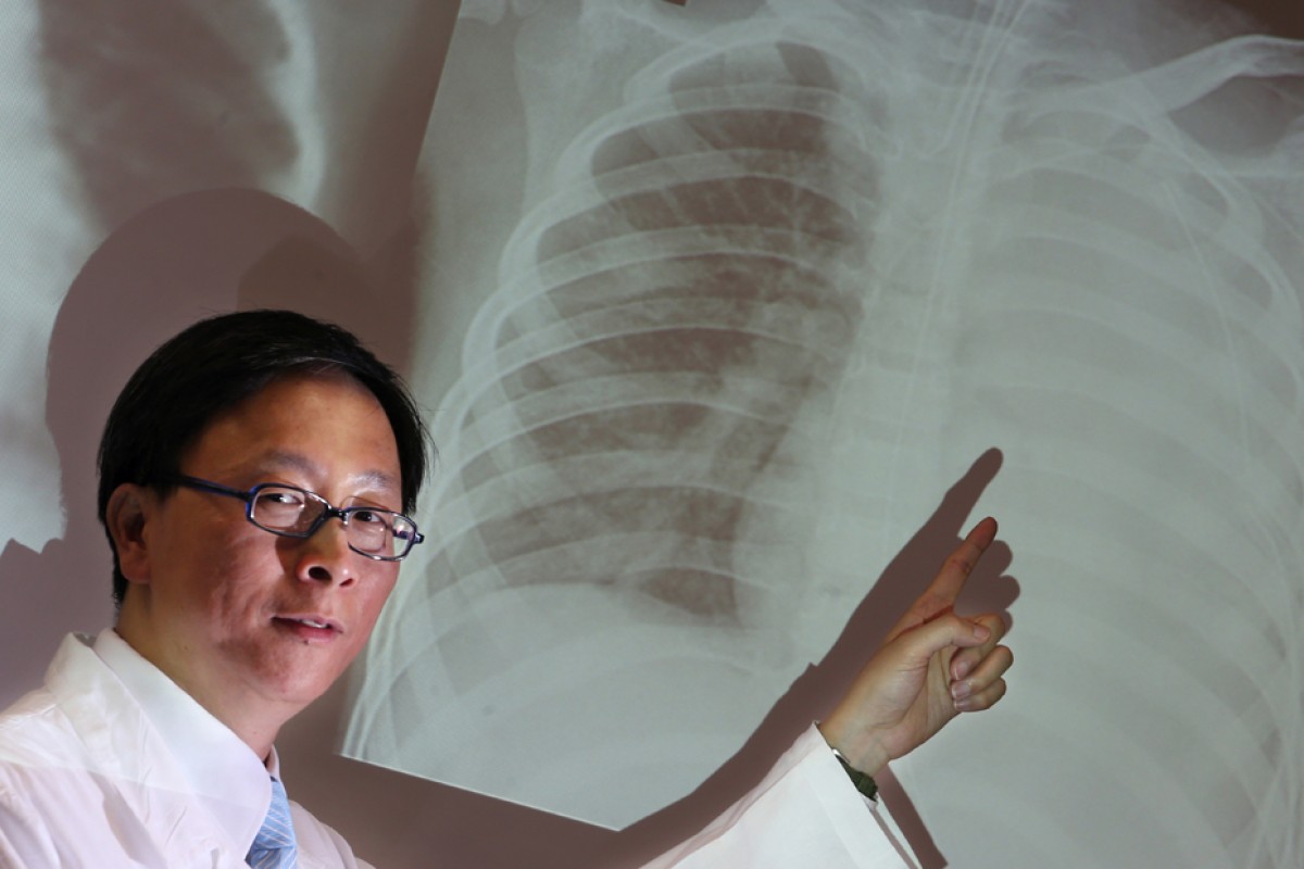 World Health Organisation's tardy reporting of Mers cases criticised ...