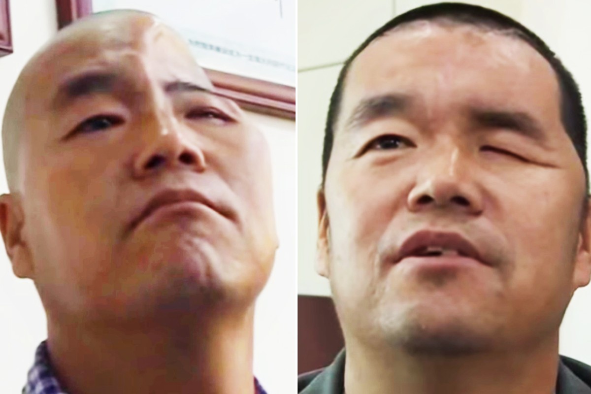 Chinese farmer fitted with 3D-printed skull 'makes full recovery' after ...