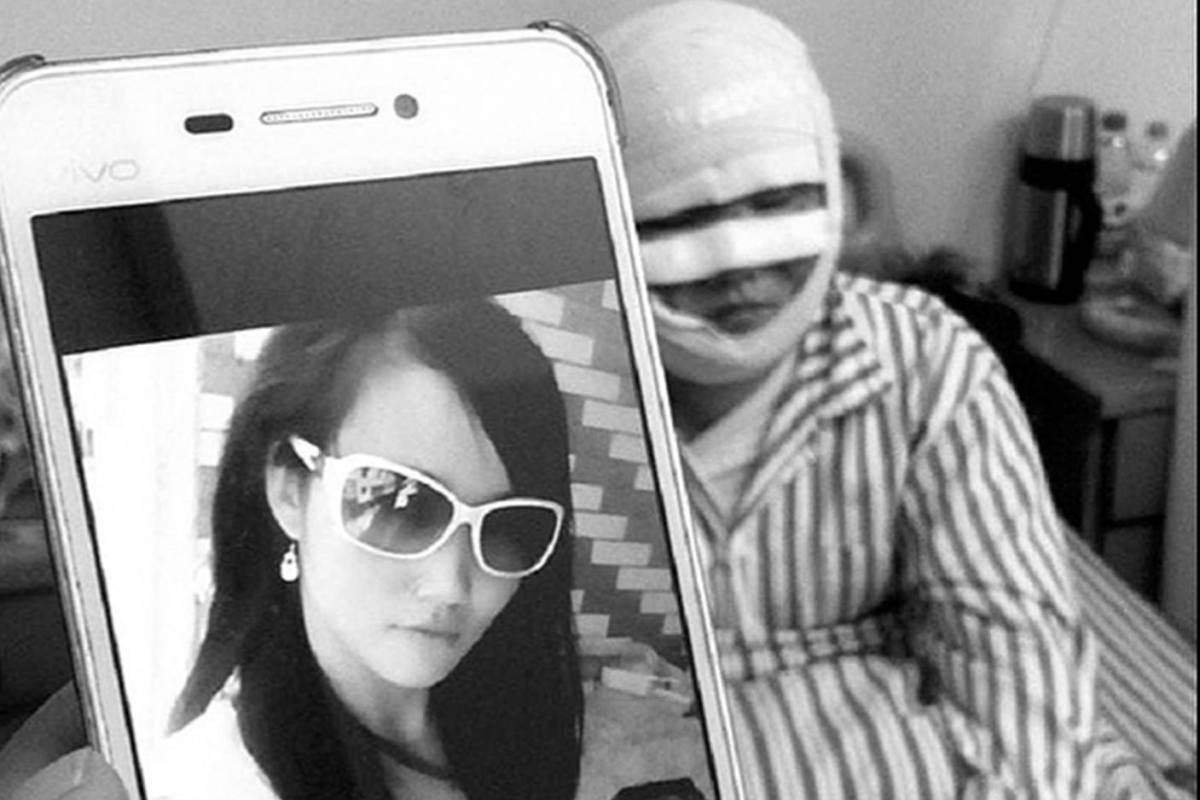 Exploding electric hot-water bottle maims woman | South China Morning Post