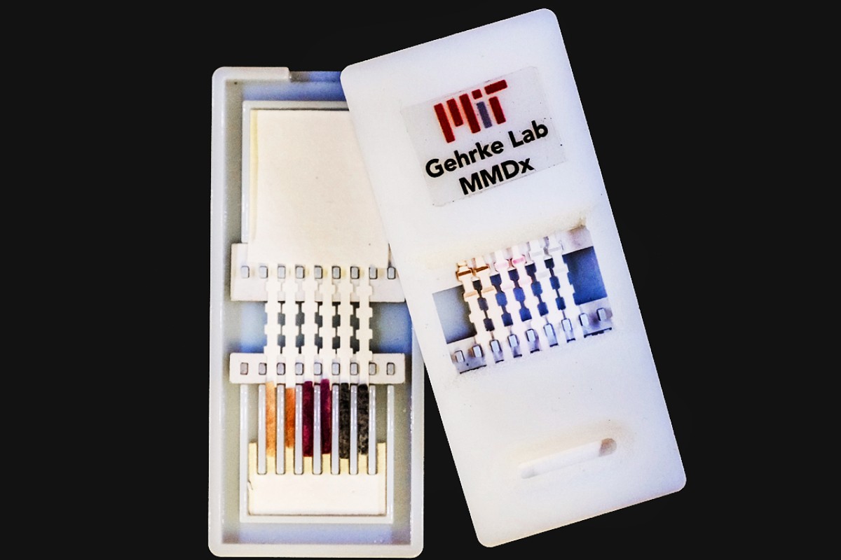 New test for Ebola dramatically cuts diagnosis time | South China ...