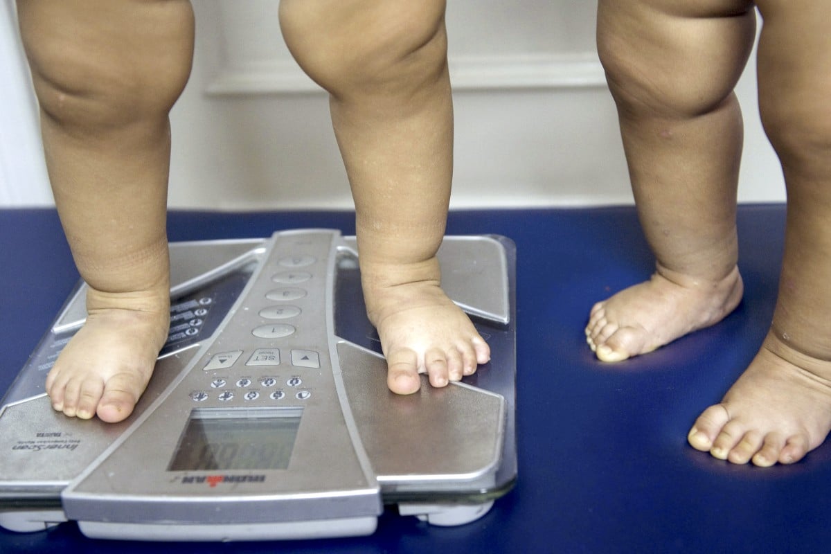 Morbidly obese Texan toddler may be youngest ‘adult-onset’ diabetes ...