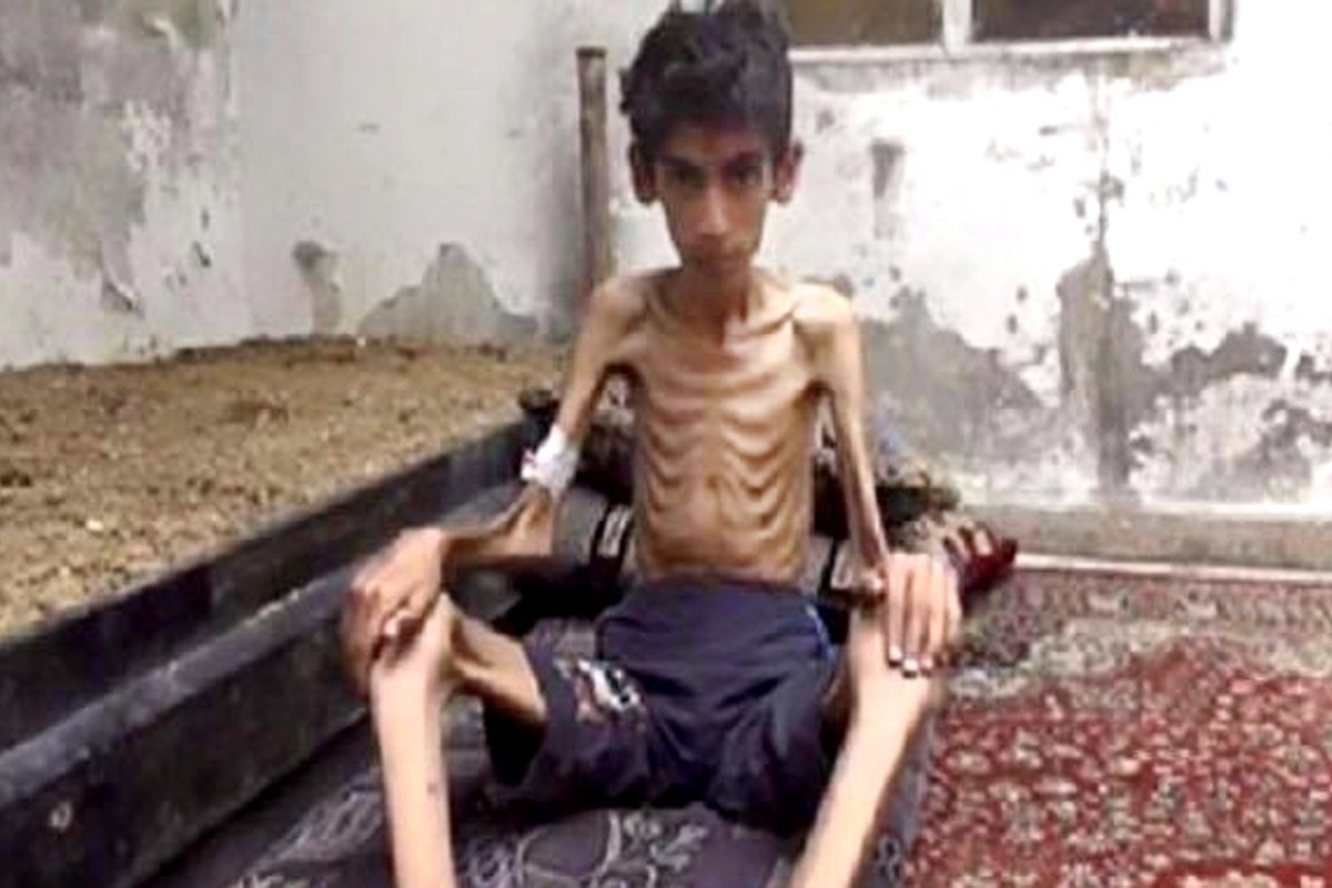 ‘We are dying in slow motion’: World recoils as appalling proof of ...