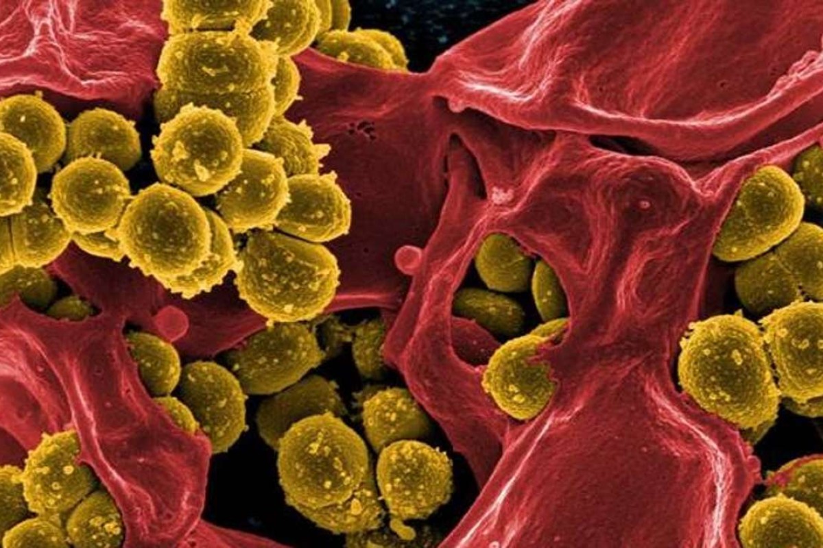 Does ‘Trojan Horse’ chemical compound DHBP spell doom for world’s ...