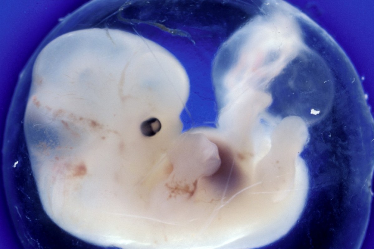 Breakthrough as first editing of human embryos carried out | South ...
