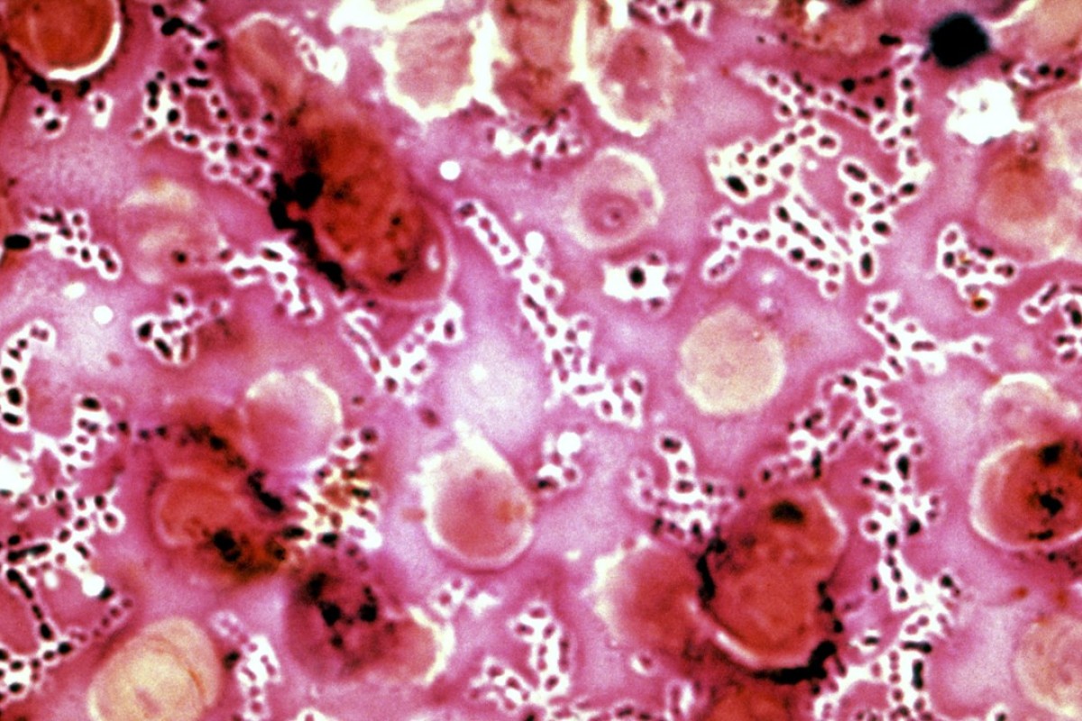 Hong Kong boy, 2, dies after pneumococcal infection in third such ...