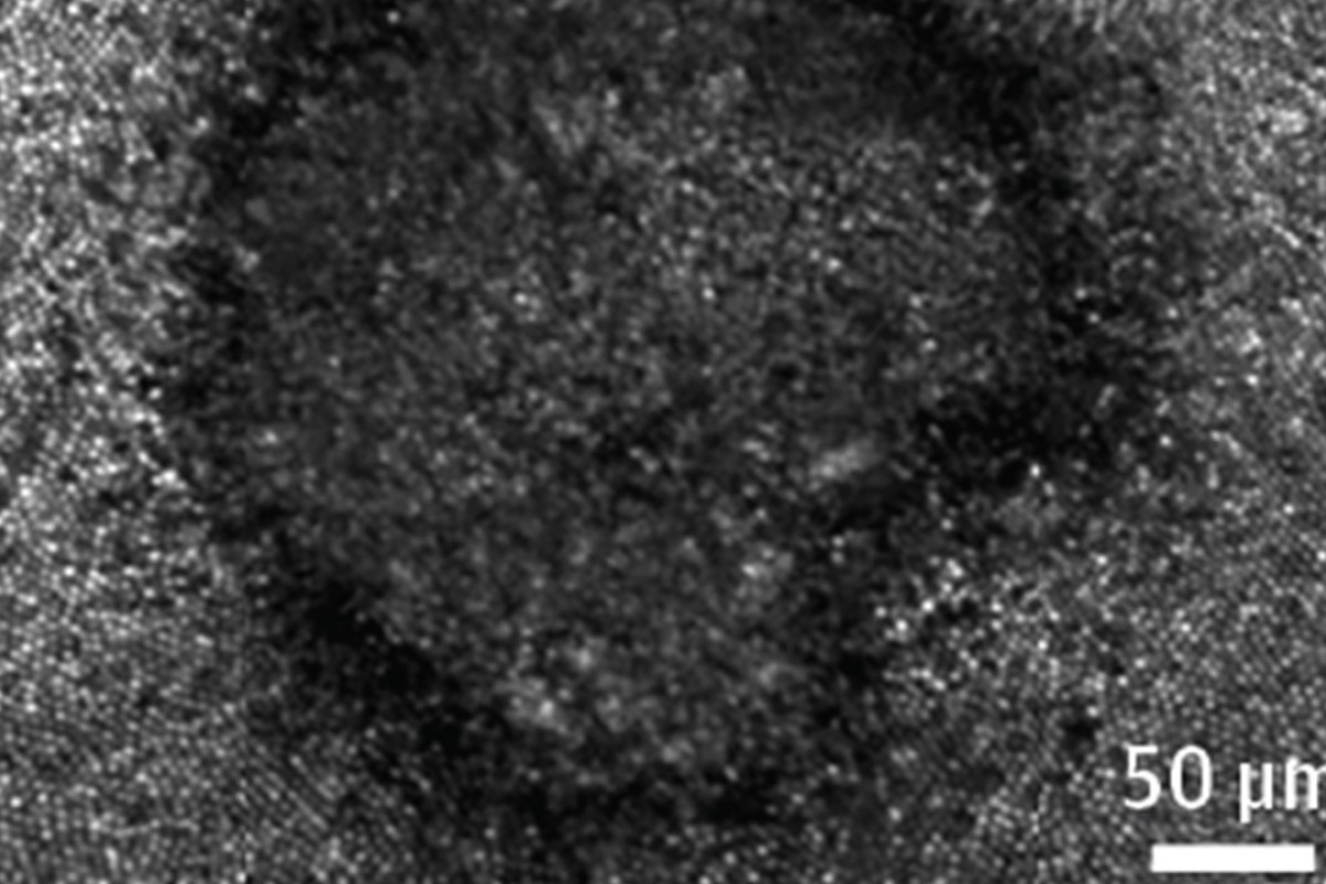 Solar eclipse was scorched on woman’s retina after she stared at sun ...