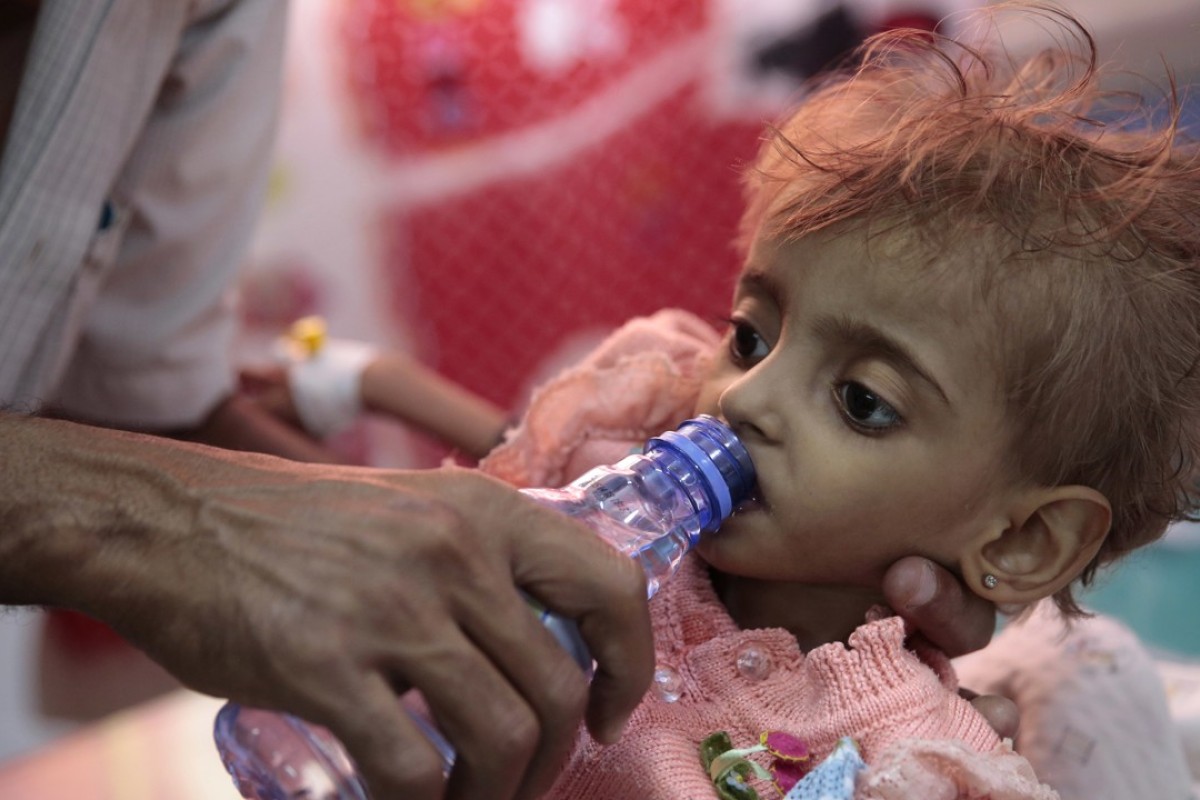 War-torn Yemen on the brink of world’s worst famine in 100 years ...