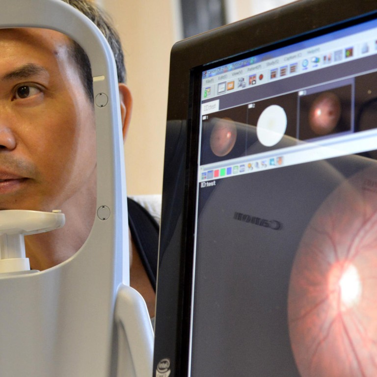 Eye scanner that can detect stroke risk developed by Chinese University ...