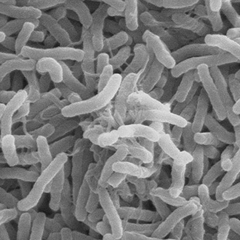 Hong Kong records first cholera case of the year | South China Morning Post