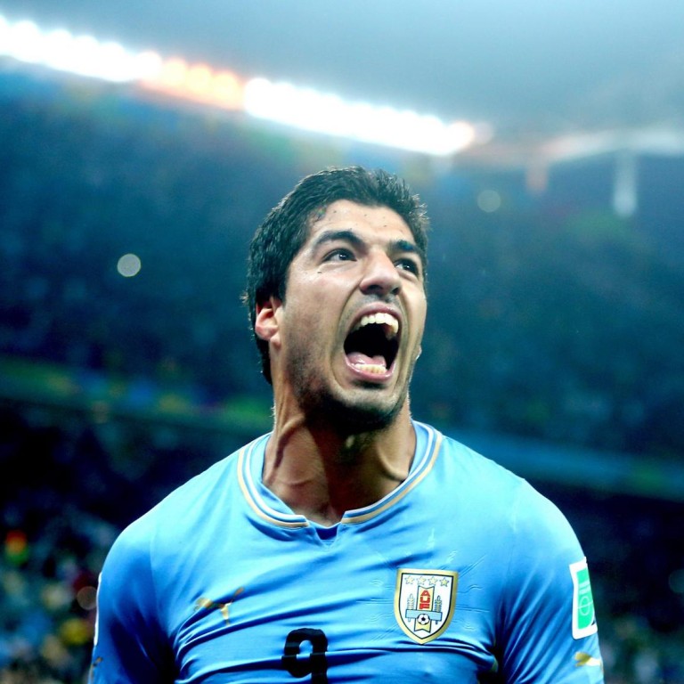 English Premier League players facing teething problems | South China Morning Post