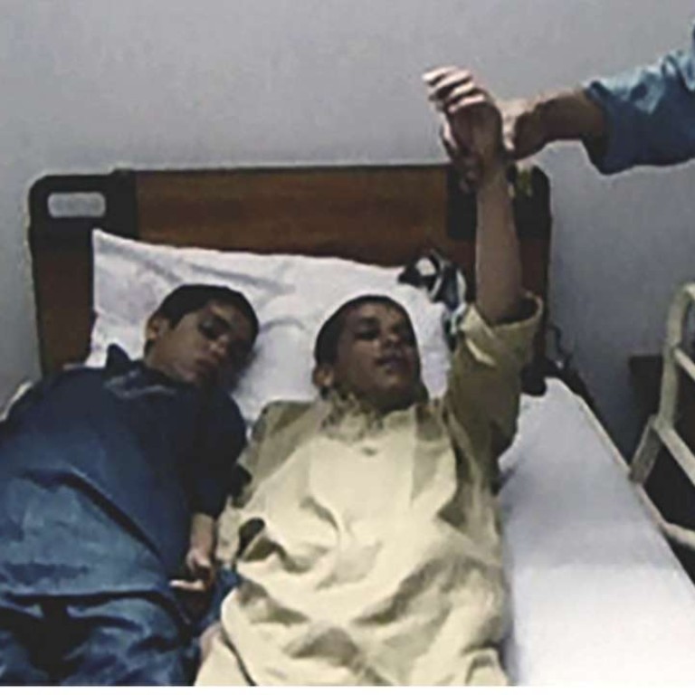 Pakistan treating two brothers known as the ‘solar kids’ who become ...