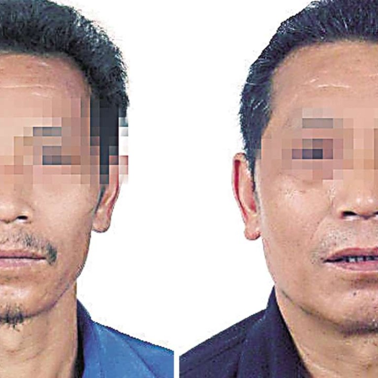 Chinese man faces identity crisis after he has large mole removed from ...