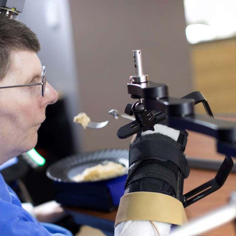 Quadriplegic man regains use of arm in medical first, thanks to ...
