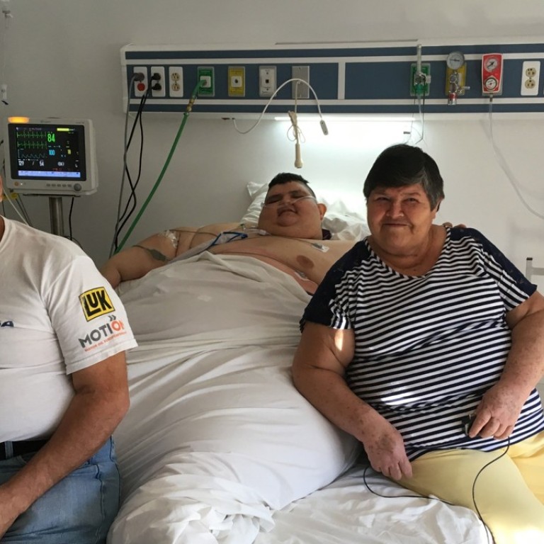 Juan Pedro Franco weighed 595kg last year. Can second surgery get him ...