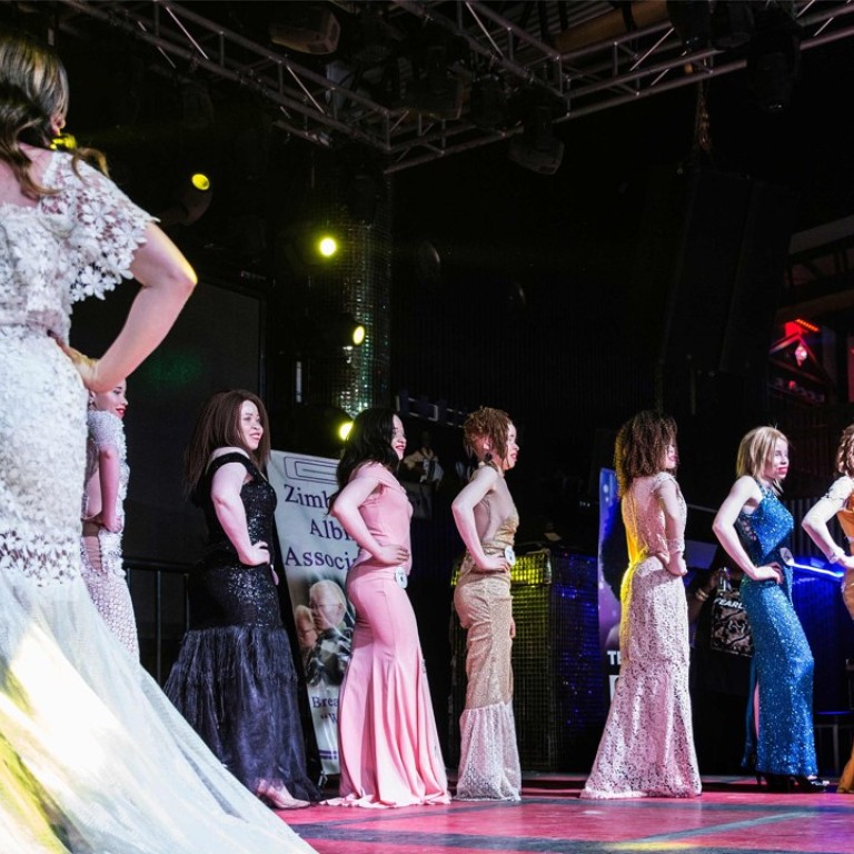 Zimbabwe holds ‘Miss Albino’ beauty pageant to fight stigma of the skin ...