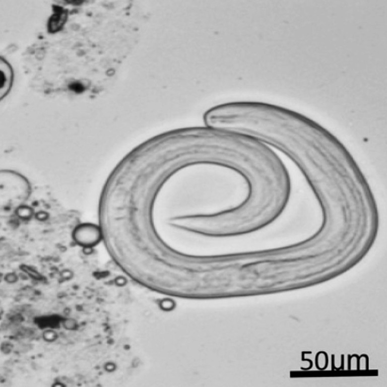 Life-threatening parasite found in Chinese patients who ate raw ...