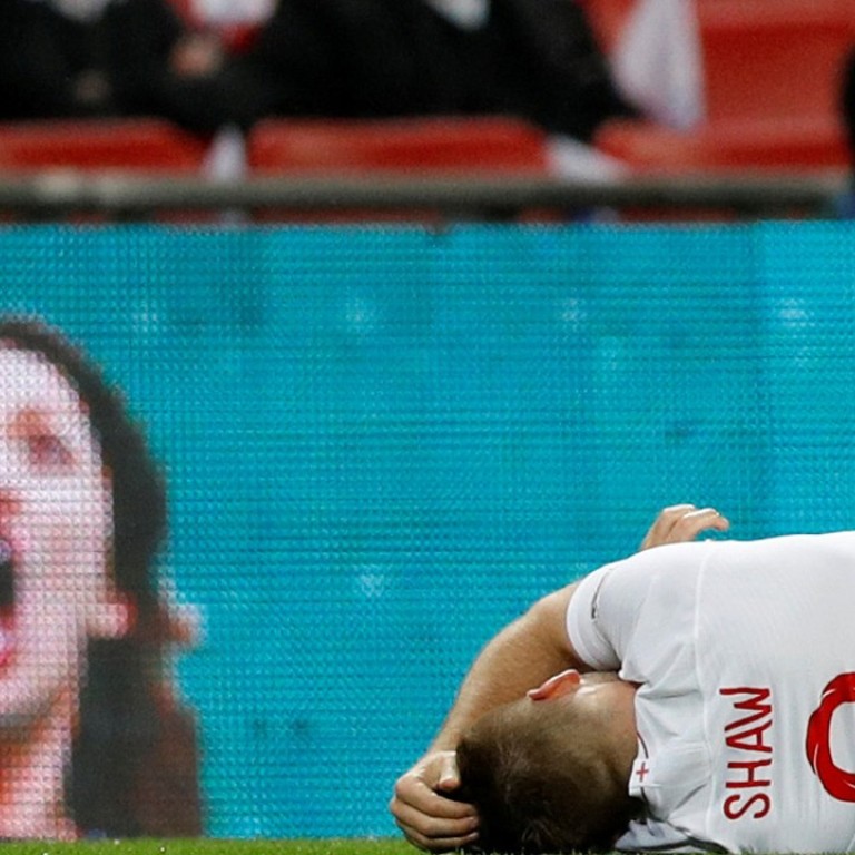 Manchester United and England defender Shaw vows to be ‘back soon ...