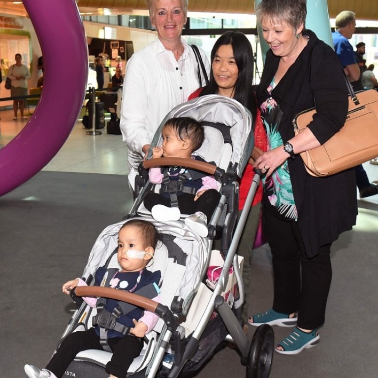 Formerly conjoined twins Nima and Dawa leave Australian hospital after ...