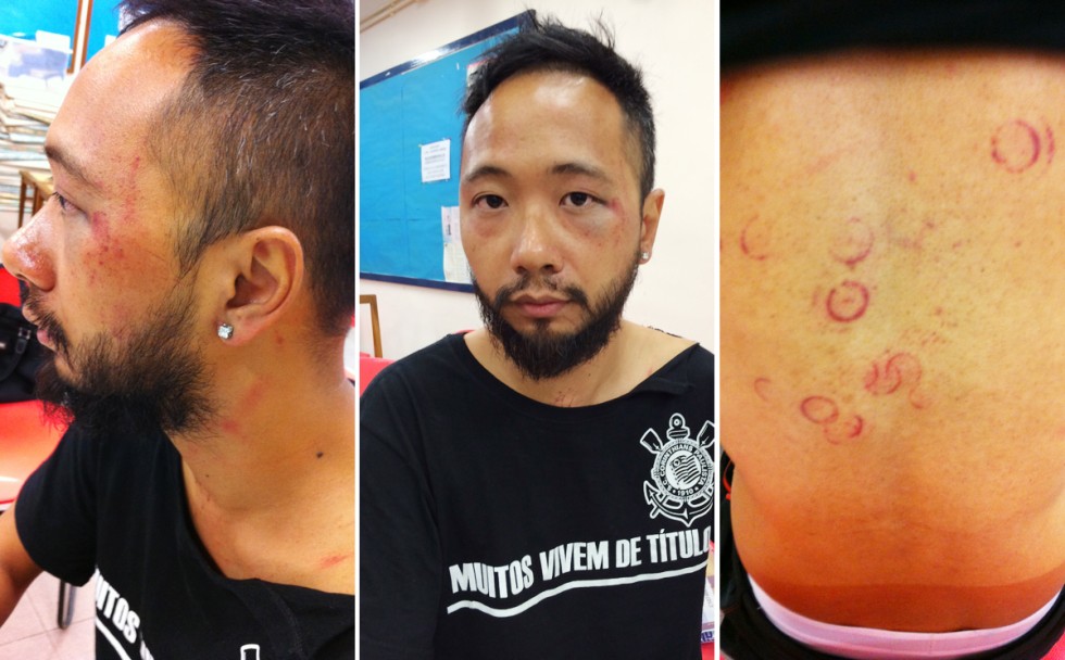 Police launch probe after alleged beating of Civic Party’s Ken Tsang ...
