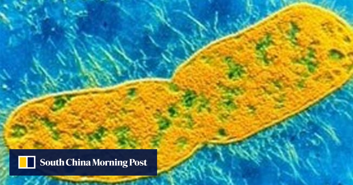 Hong Kong has right conditions for outbreaks of drug-resistant ...