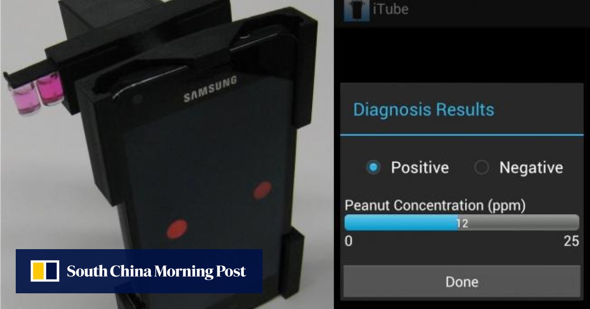 Allergy sufferers to benefit from mobile phone testing device | South ...