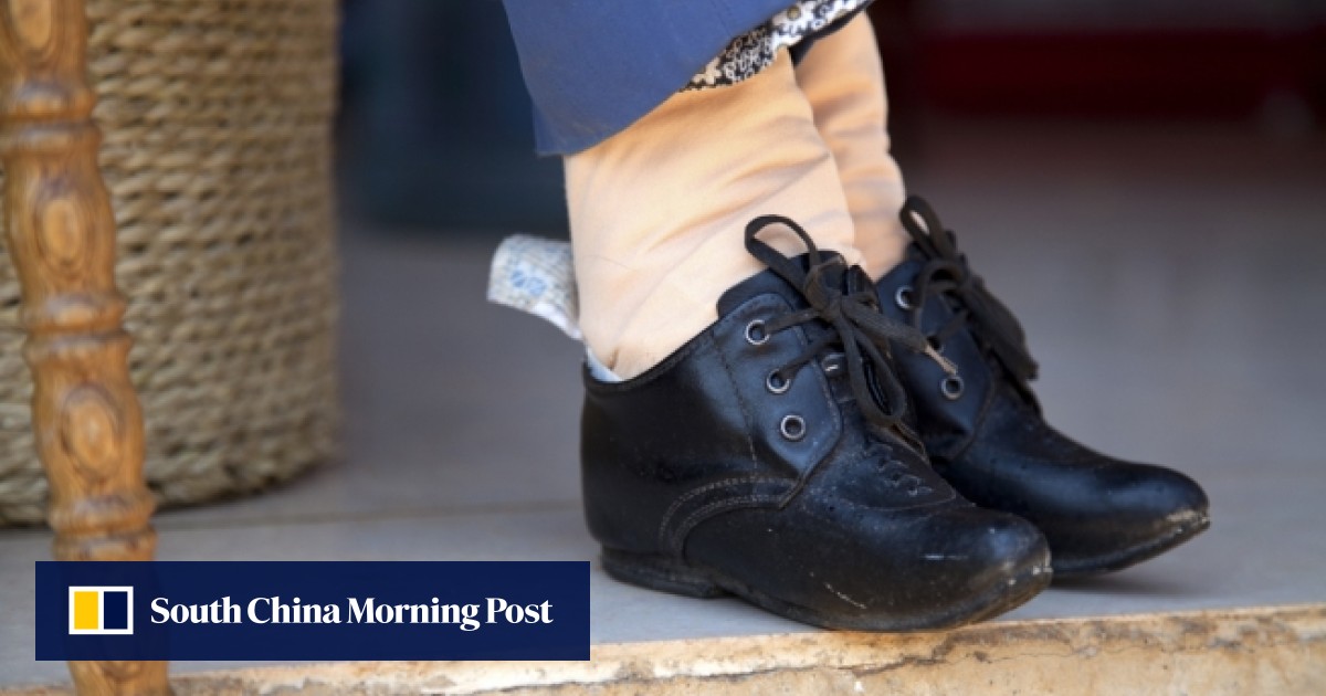 Foot binding in China: tales from Yunnan women who underwent the ...