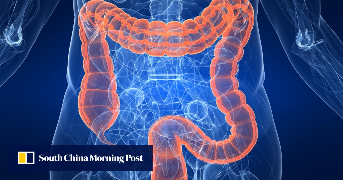 Hits & Myths: are colon-cleansing products necessary for a healthy gut ...