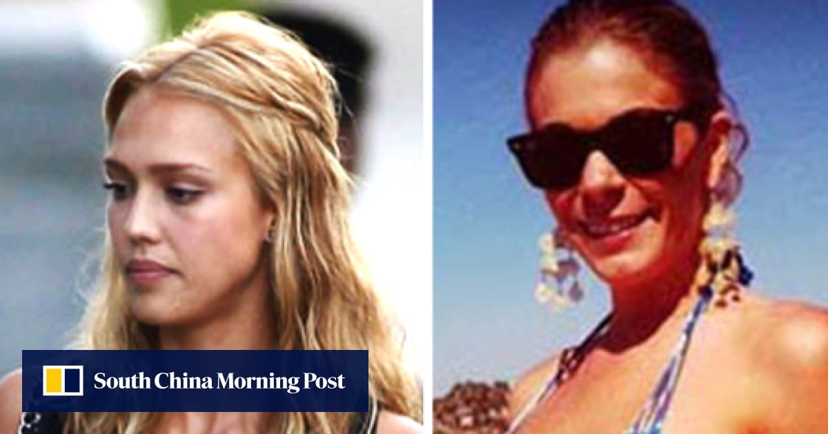 Adverts and exposure to images of celebrity bodies linked to rise in ...