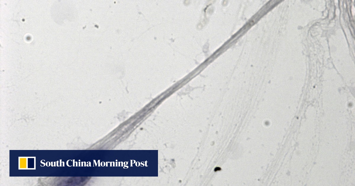 Scientists create test-tube human sperm from stem cells, but don’t know ...