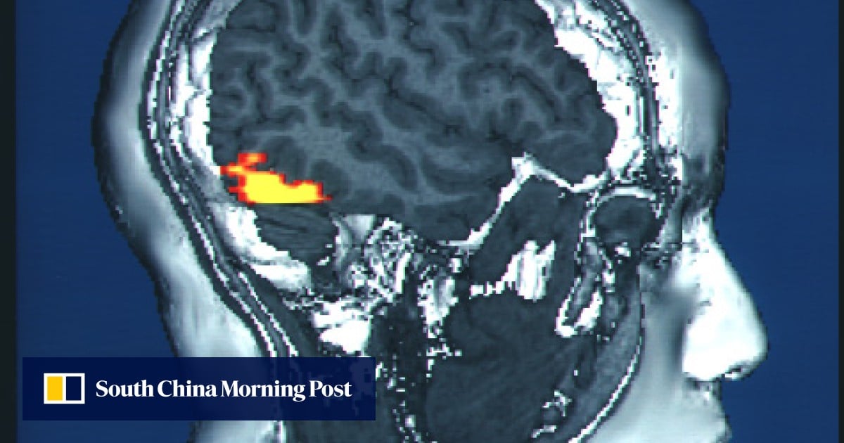 fusiform face area example