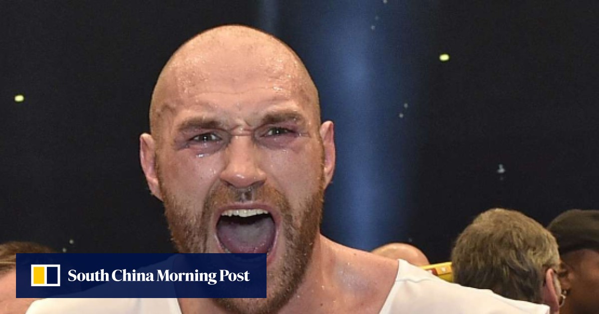 Tyson Fury gives up his titles to focus on his mental health | South ...