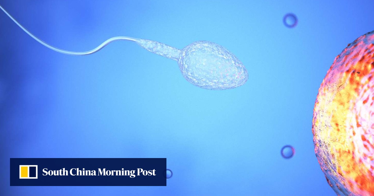 Five things to know about IVG – a new way to have babies by turning any ...