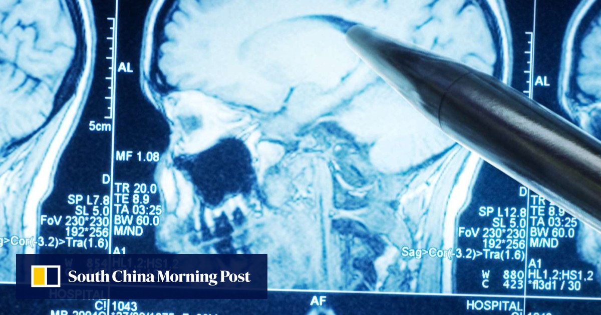 Why do Asians have bigger brains than Europeans or Africans? | South ...