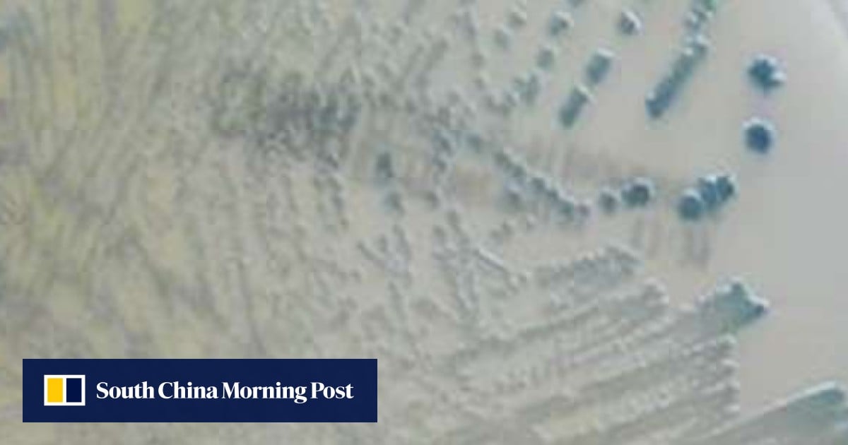 ‘Number one enemy’ superbug cases double in Hong Kong’s public ...