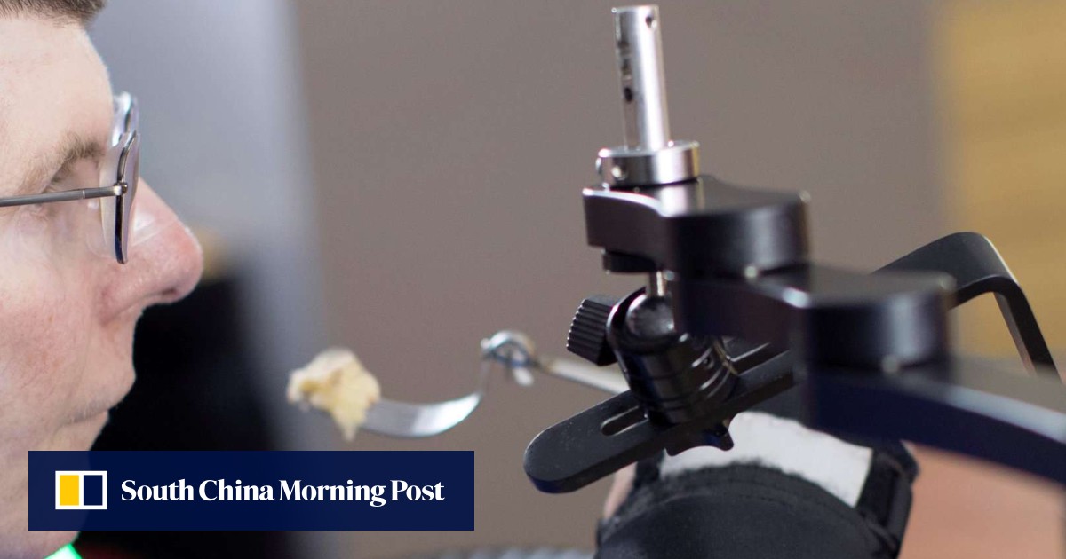 Quadriplegic man regains use of arm in medical first, thanks to ...