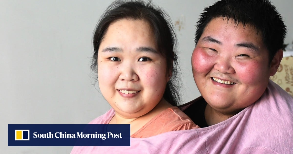 Morbidly obese Chinese couple loses 200kg between them so they can ...