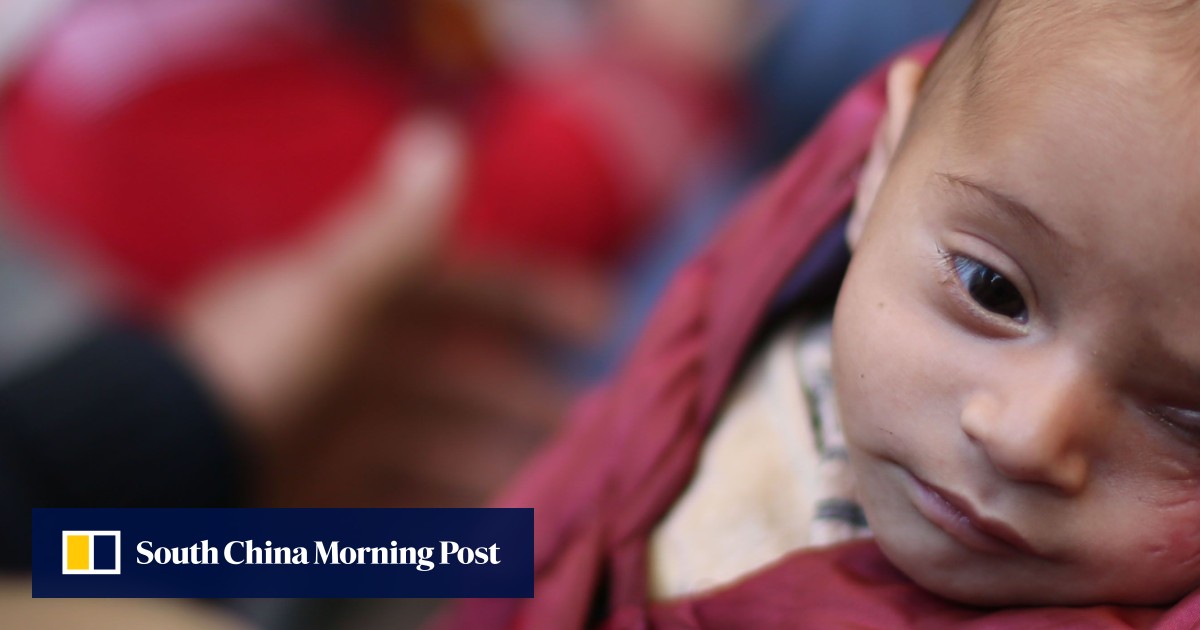 Blinded in one eye, baby Karim becomes a heartbreaking symbol of Syrian ...