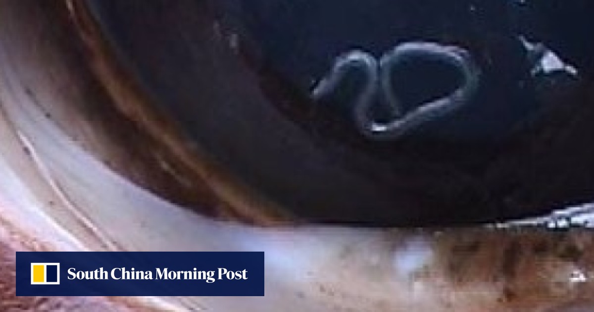 Colony of 14 parasitic worms extracted from woman’s eye, in first human ...
