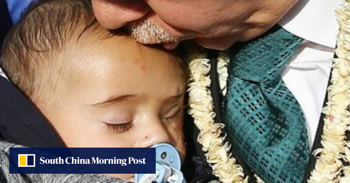 One-eyed Syrian baby whose plight set off viral campaign online arrives ...