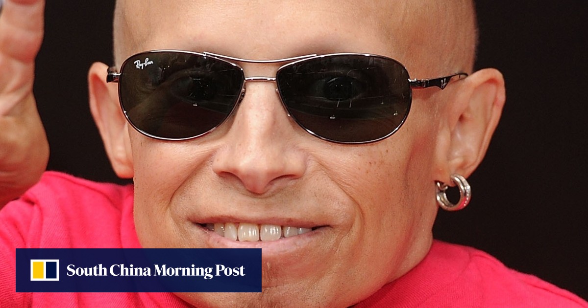 Actor Verne Troyer, ‘Mini-Me’ from the Austin Powers films, dies aged ...