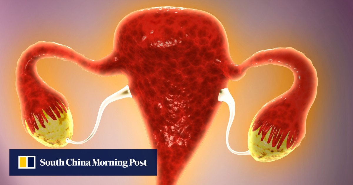 Scientists create ‘artificial ovary’ that could help women conceive ...