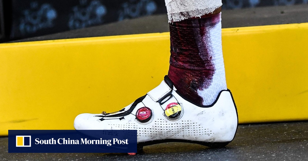 Tour de France: Philippe Gilbert’s race over after ‘lucky escape ...